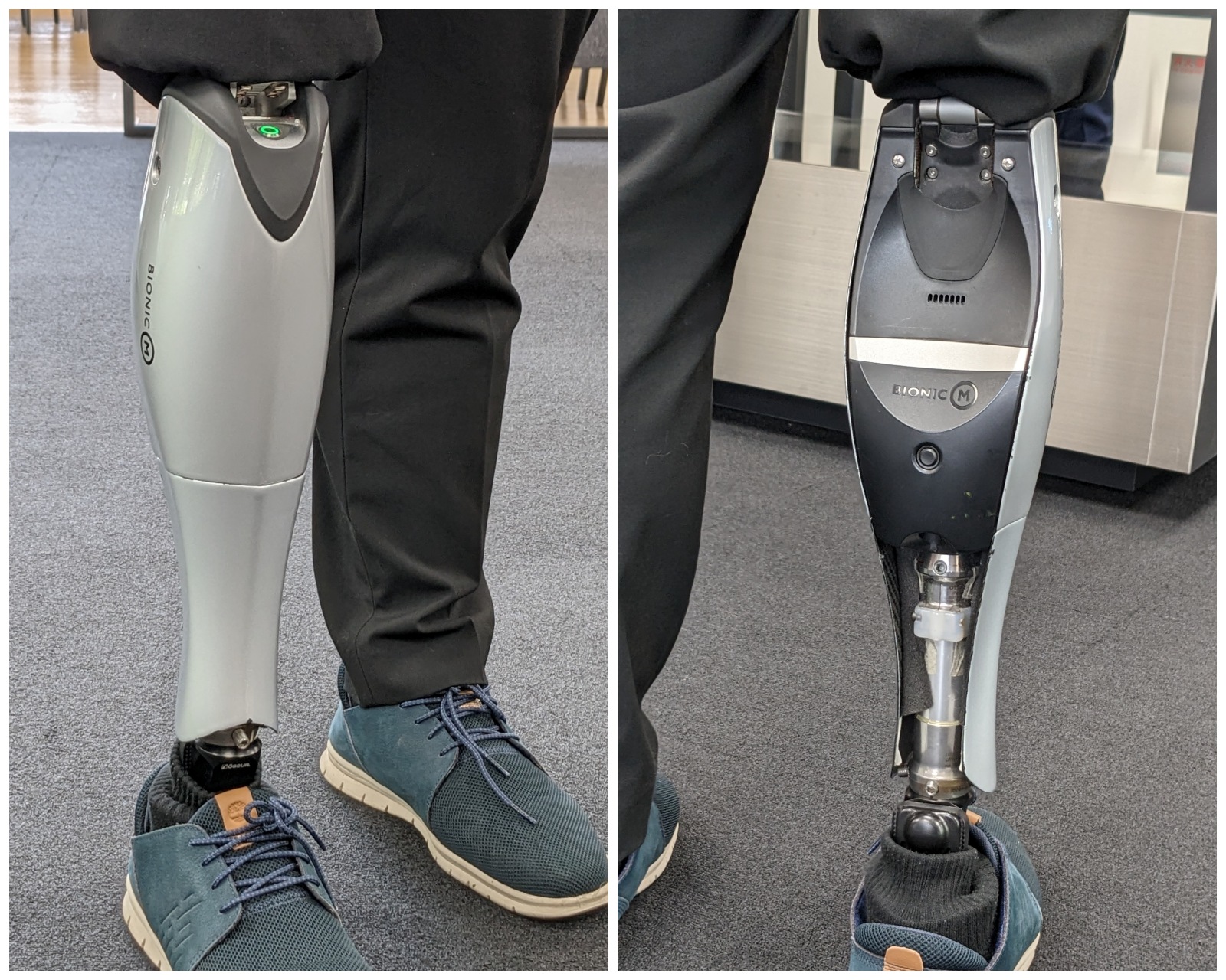 ロボット義足から人間拡張へ、挑戦者を支えるTHKの狙いとは | 日経クロステック（xTECH）